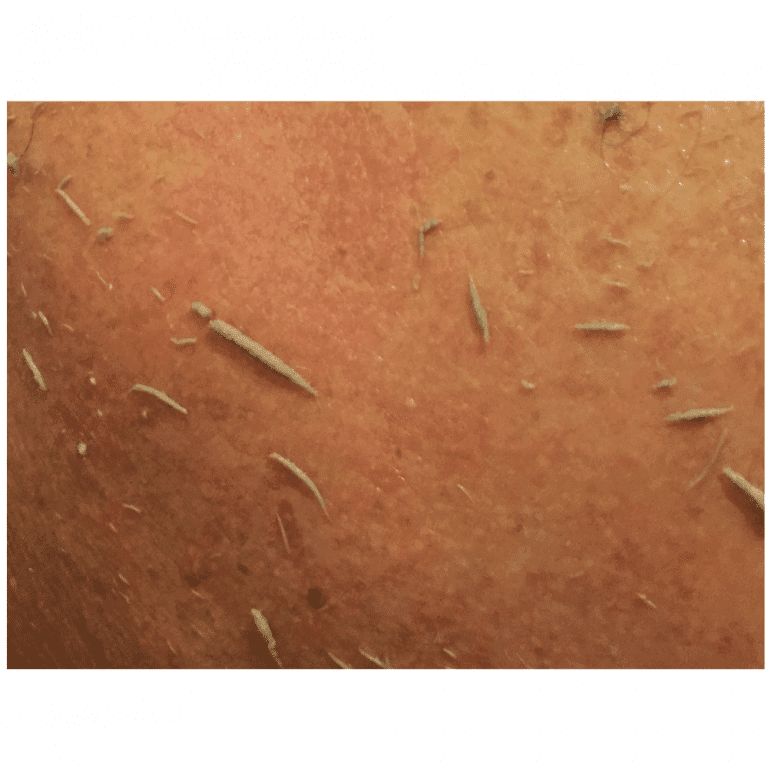 Baiden Mitten Exfoliator System – Baiden Mitten