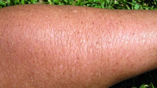 The Baiden Mitten Exfoliator - Baiden Mitten